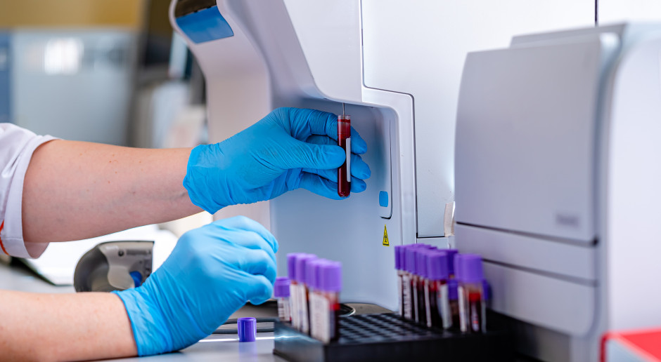 NFZ zapłaci za dwa nowe badania. Opublikowano nowy wykaz